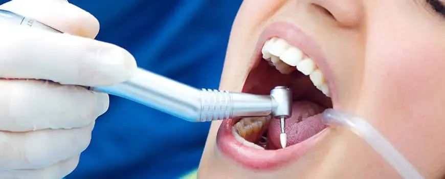 Application D'implants Dans Le Traitement Des Déficiences Dentaires ...