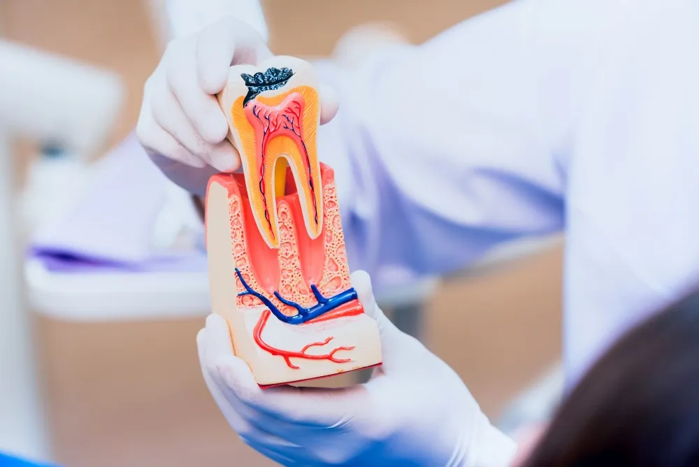 Considerations After Dental Filling - Hospitadent