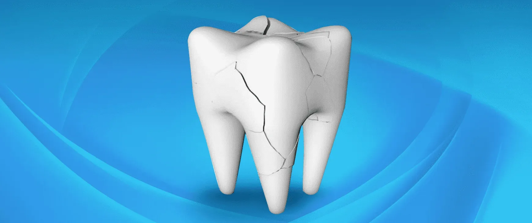 What Is a Tooth Fracture? How Is It Treated? - Hospitadent